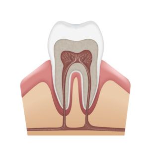 What Causes an Exposed Tooth Root? Risks and Prevention Tips